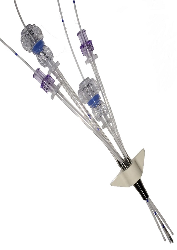 Hemedex, Inc. Joins Attainia: Healthcare Capital Equipment Planning ...